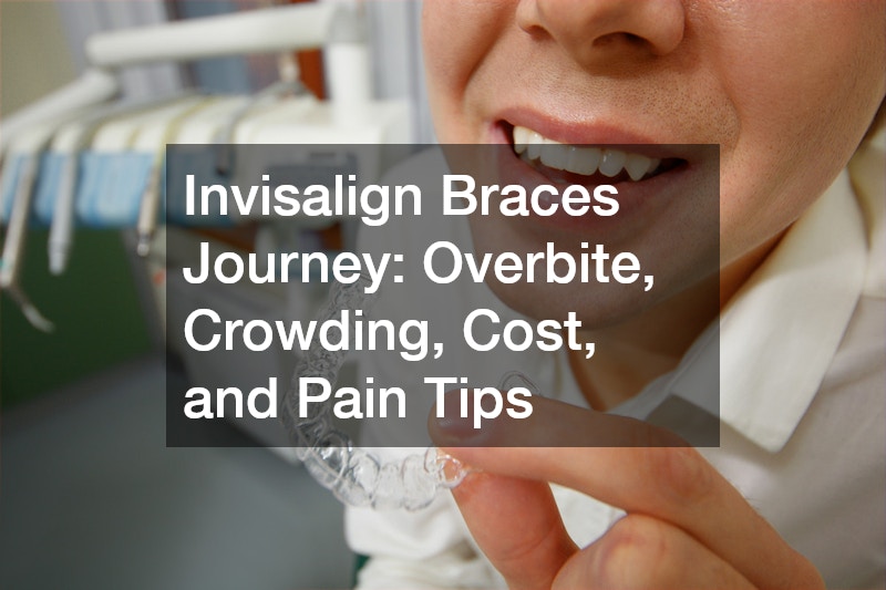 Invisalign Braces Journey: Overbite, Crowding, Cost, and Pain Tips ...